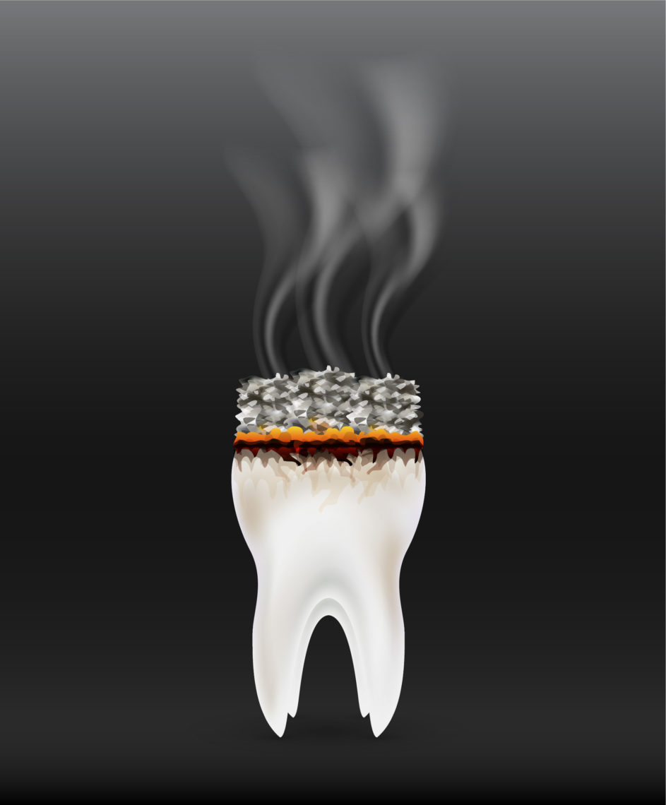 Blog – Waterloo Dental Clinic